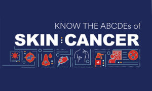 Understanding the ABCDEs of Skin Cancer Detection - Fast Pace Health